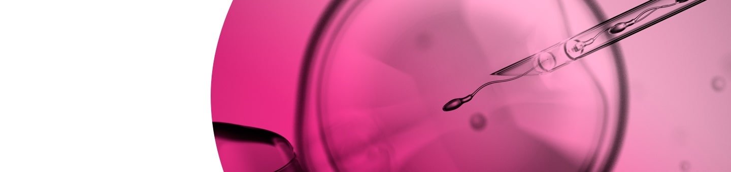 Micro-injection spermatique ICSI et IMSI | Barcelona IVF