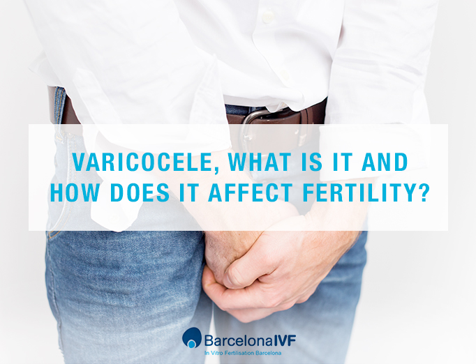 Varicocele How Does It Affect Fertility Barcelona Ivf